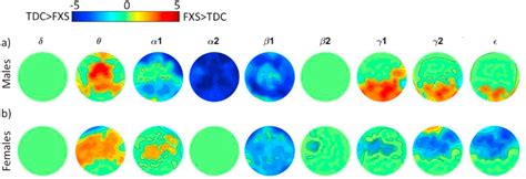Sex Differences In Resting EEG Power In Fragile X Syndrome Abstract Europe PMC