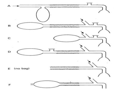 Mapleson System