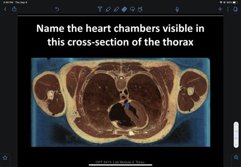 T8 Image Cross Section Diff View Diagram Quizlet