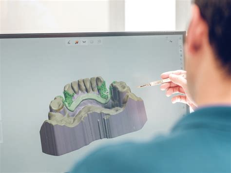 디지털 덴티스트리 시대 고연차 치과위생사 ‘스트레스