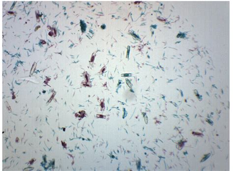 Fungi Mixed Diatoms Wholemount Prepared Microscope Slide 75x25mm
