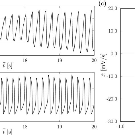 Ventricular Flutter A Real ECG Signal B Simulated Time Series C Download Scientific