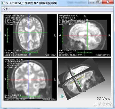 在工业上 用qt开发界面相对来说流行吗 ？虽然在互联网行业qt并不受欢迎？ 知乎