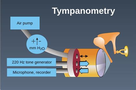 Tympanometrysvg Eustachian Tube Dysfunction Middle Ear Ear Pressure