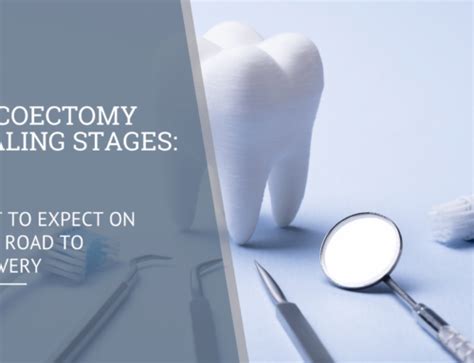 Apicoectomy Healing Stages Insights Into Your Recovery Journey