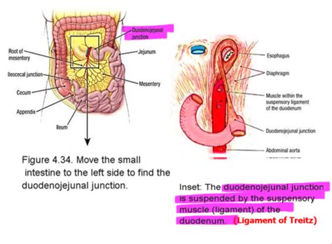 Gi Bleeding Flashcards Quizlet