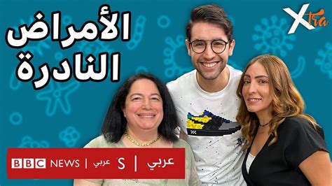 أمراضٌ نادرة Bbc News عربي