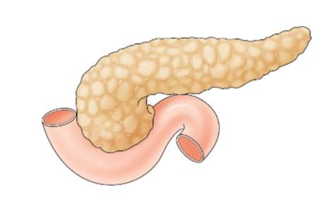 양기영의 췌담도암 진 료 후 급성췌장염 만성췌장염 그리고 췌장암