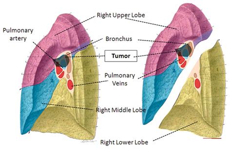 Lung Parenchyma Anatomy