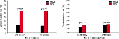 Comparison Of Cancer Detection Rate Trus Transrectal Ultrasonography Download Scientific