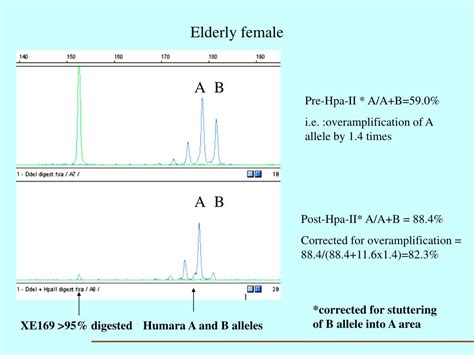 Ppt G6pd Deficiency In Hong Kong Diversity And Clinical Relevance