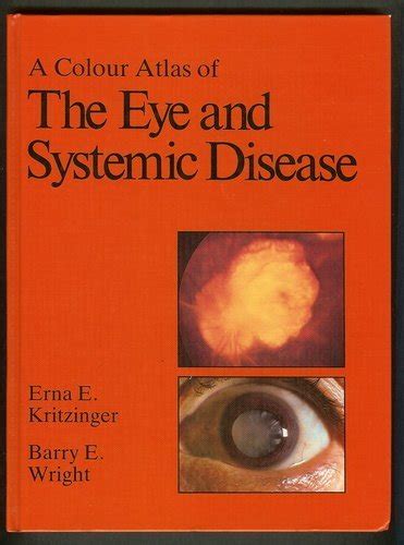 A Colour Atlas Of The Eye And Systemic Disease Wolfe Medical Atlases