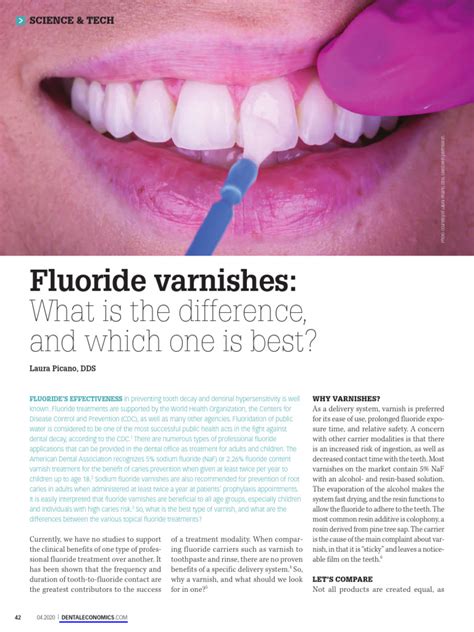 Varnish Pdf Dentistry
