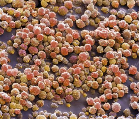 Archaea Sem Stock Image C0608397 Science Photo Library