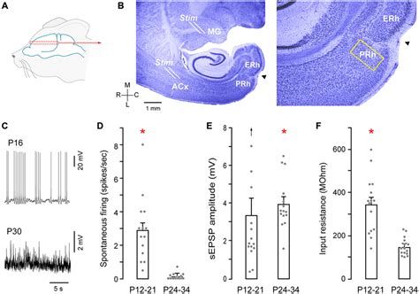 Auditory Thalamocortical—perirhinal Cortex Prh Brain Slice Download Scientific Diagram