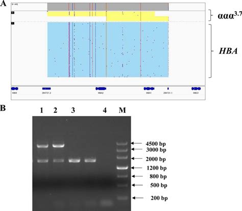 Identification And Verification Of α Globin Gene Triplication A