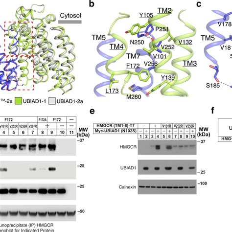 Cryo Em Structure Of The Hmgcrtm Ubiad1n102s Complex A Overview Of