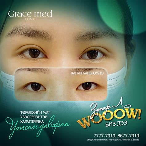 Grace Med гоо сайхан мэс заслын эмнэлэг Home