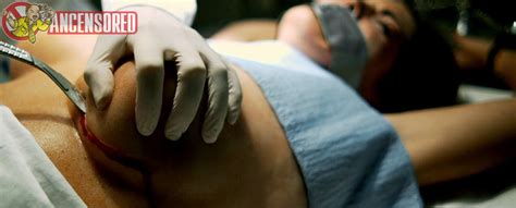 Sutures nude pics página 1