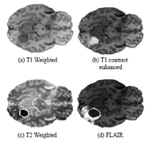 An Illustration Of The Dataset With A Single Mri Slice At Four Download Scientific Diagram