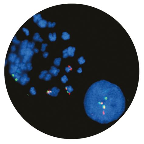 Cytocell Bcrabl Translocation Dual Fusion Fish Probe