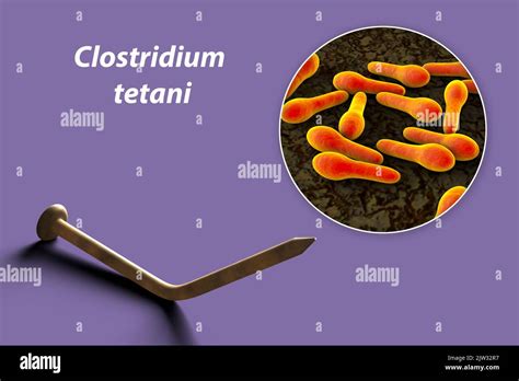 Transmission Of Tetanus Bacteria Conceptual Illustration Showing An Old Rusty Metal Nail As A