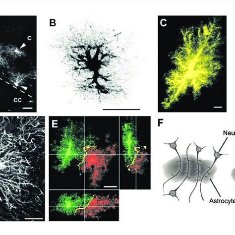 Dimensions Of Normal Protoplasmic And Fibrous Astrocytes As Measured By Download Table