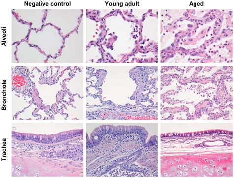 Histology Of Lungs From Sars Cov Infected Aged Macaques Lesions In Download Scientific Diagram