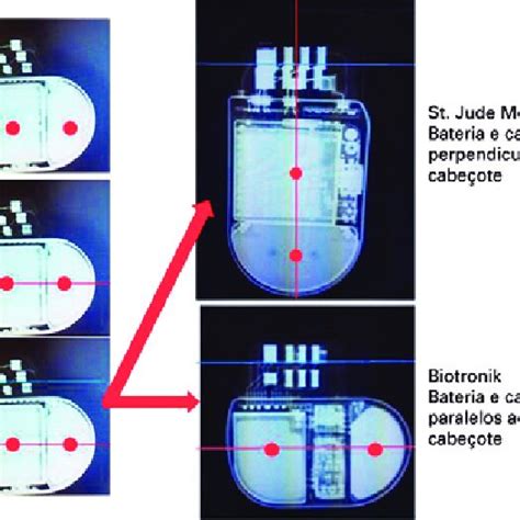 Algoritmo Proposto Para Avalia O Das Caracter Sticas Radiol Gicas