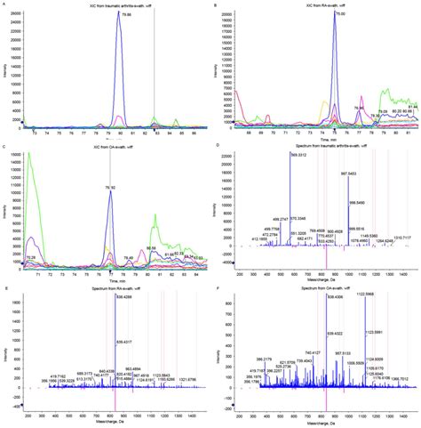 Proteomic Analysis Of Synovial Fluid In Osteoarthritis Using Swath‑mass