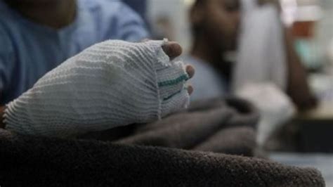 Cinco niños resultan heridos por utilizar pirotecnia en Sonora La