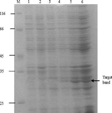 Figure 6 From Cdna Cloning And Expression Analyses Of The Isoflavone Reductase Like Gene Of