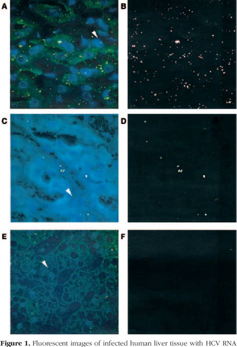 Figure 1 From Dynamics Of Hepatitis C Virus Replication In Human Liver Semantic Scholar