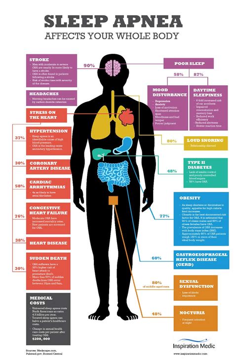 Obstructive Sleep Apnea Explained Inspiration Medic