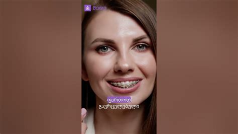 როგორი ბრეკეტების არსებობს Youtube