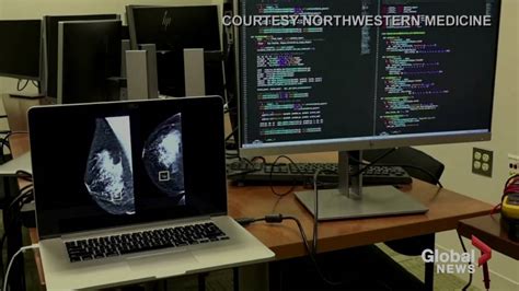 Ai Can Spot Breast Cancer Better Than Humans Study Finds National