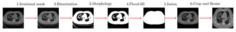 Preprocessing Steps Done On Ct Images Download Scientific Diagram