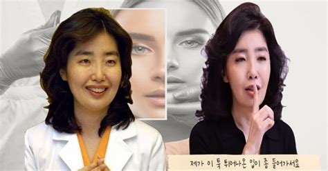 성형 진짜 안했어요 여에스더 이것 꾸준히 했더니 예뻐져