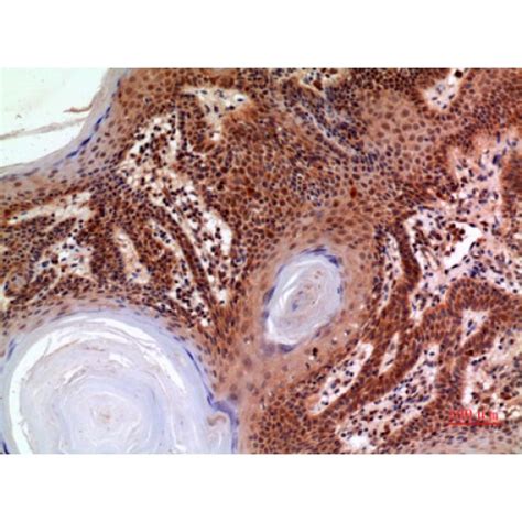 Anti A2m Alpha 2 Macroglobulin Antibody Rabbit Anti Human Lsbio