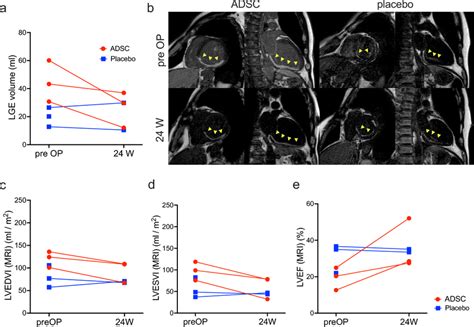 Lge Mri And Cardiac Function Before Versus After Surgery The Lge Mri Download Scientific