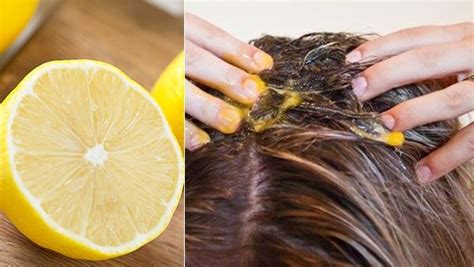 How To Remove Lice From Hair Permanently In Urdu Remedy Benefits
