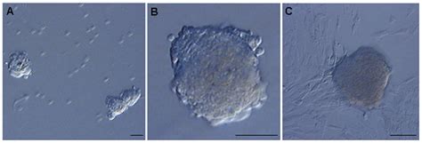 Generation Of Neurospheres From Human Neural Precursors Cells Isolated