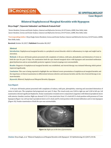 Pdf Bilateral Staphylococcal Marginal Keratitis With Hypopyon