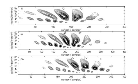 Continuous Wavelet Transform Cwt For The Second Sound S Of The