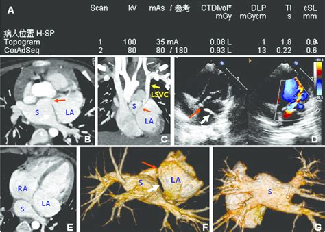 Representative Multi Slice Spiral Computed Tomography Images From A Download Scientific Diagram