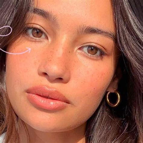 New Procedure For Under Eye Bags Before And After News Photos