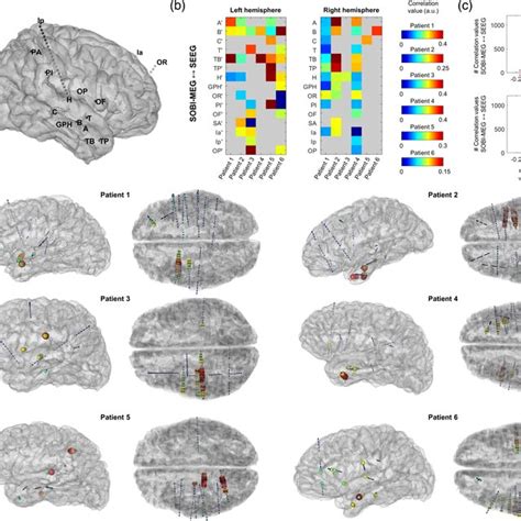 Second‐order Blind Identification Sobimagneto Encephalographic Meg Download Scientific