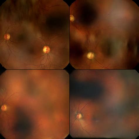 Generated Fundus Images Have Significant Artifacts · Issue 2 · Mueller