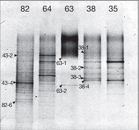 Dgge Analysis Of Bacterial 16s Rrna Gene Fragments Obtained From