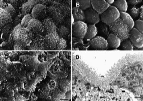 Scanning Electron Microphotographs Of The Choroid Plexus Of Mouse Download Scientific Diagram